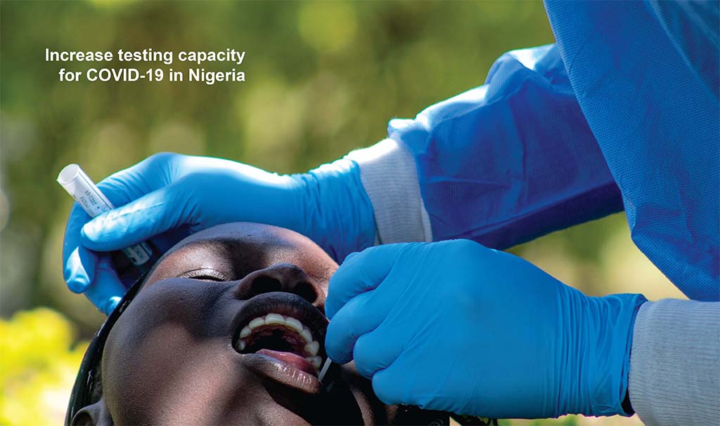 Increase testing capacity for COVID-19 in Nigeria - AFENET